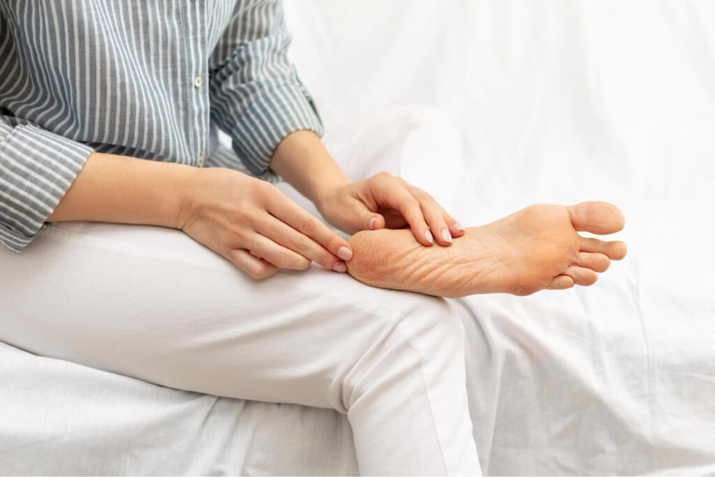 Metatarsalgia / Pain in Ball of Foot - Bespoke Podiatry - Union Square ...